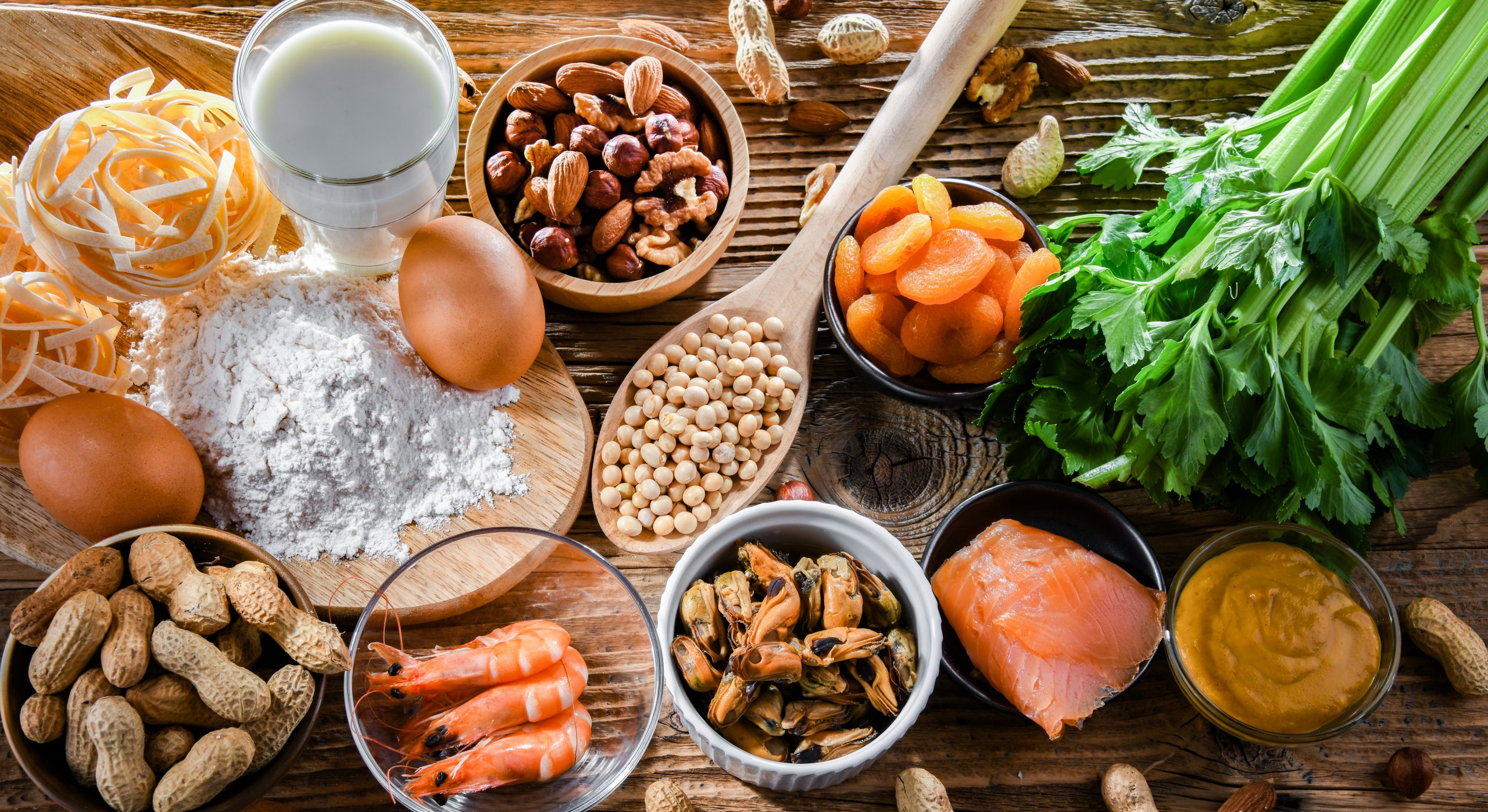 Food Allergies and Special Dining Needs | Campus Dining